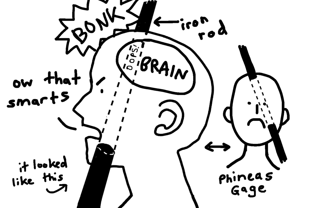 How a transnasal lobotomy made me reevaluate my life - Campus Times