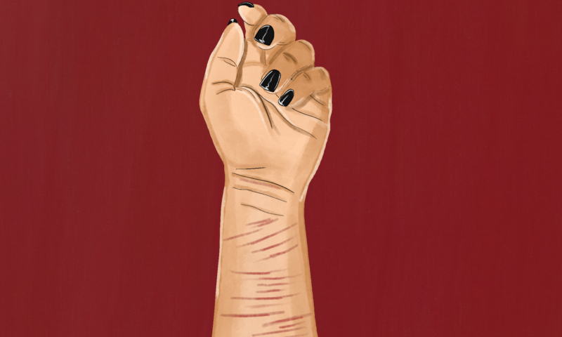 Scars From Cutting Myself